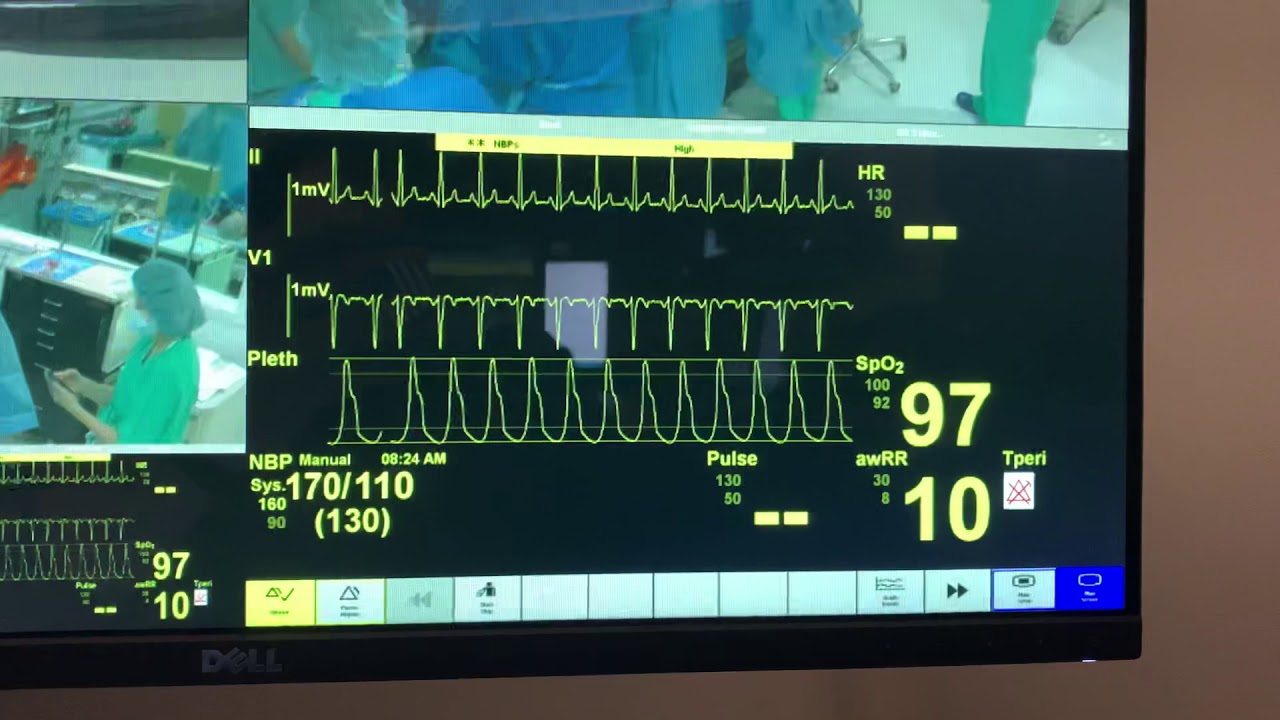 Laerdal Patient Monitor Issue - YouTube