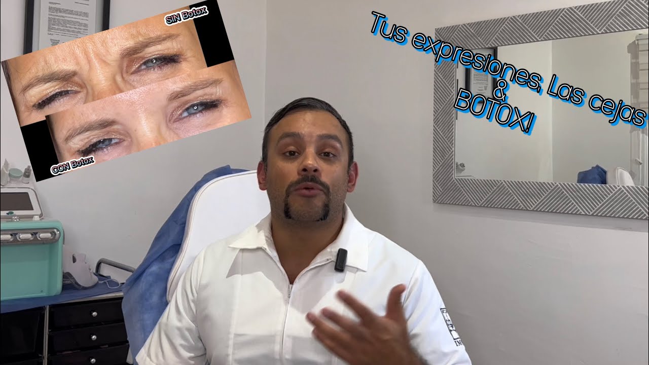 Botox, las cejas y tus expresiones - YouTube