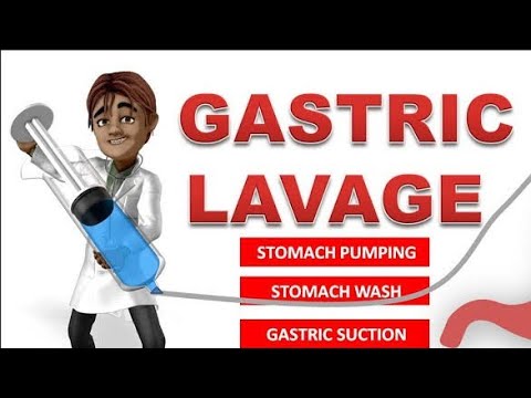 Gastric Lavage full procedure - YouTube