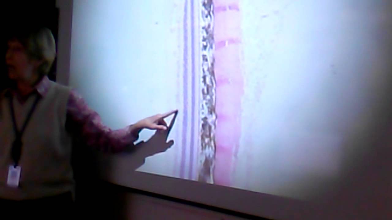 Monkey eye Retina Slide - YouTube