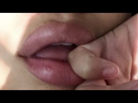 ୨୧ russian lip filler