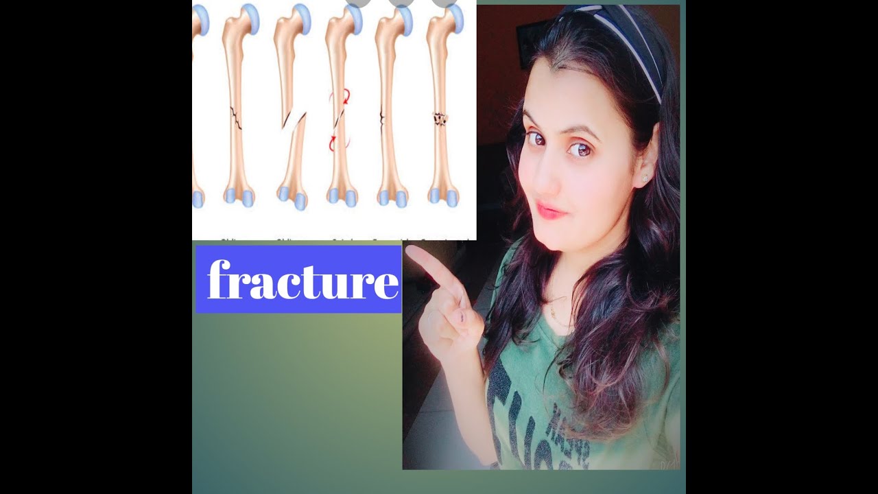 skeletal system disorder( fracture) - YouTube