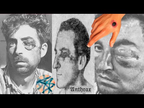 The TERRIFIC History of Anthrax - YouTube