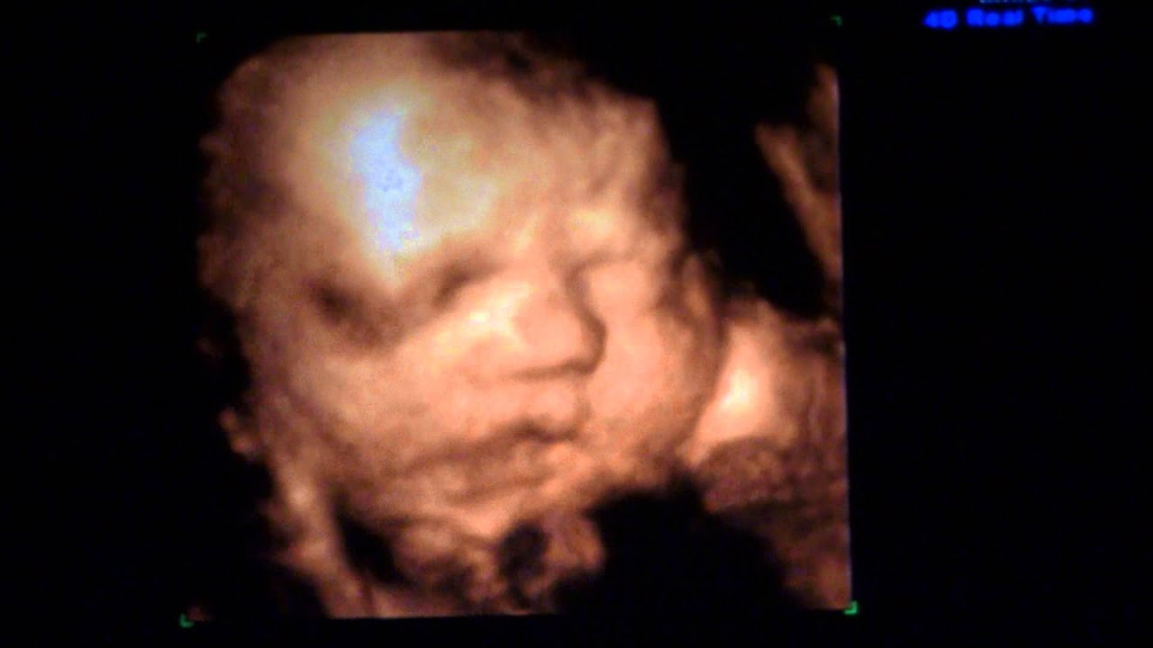 3D/4D Ultrasound at 30 weeks - YouTube