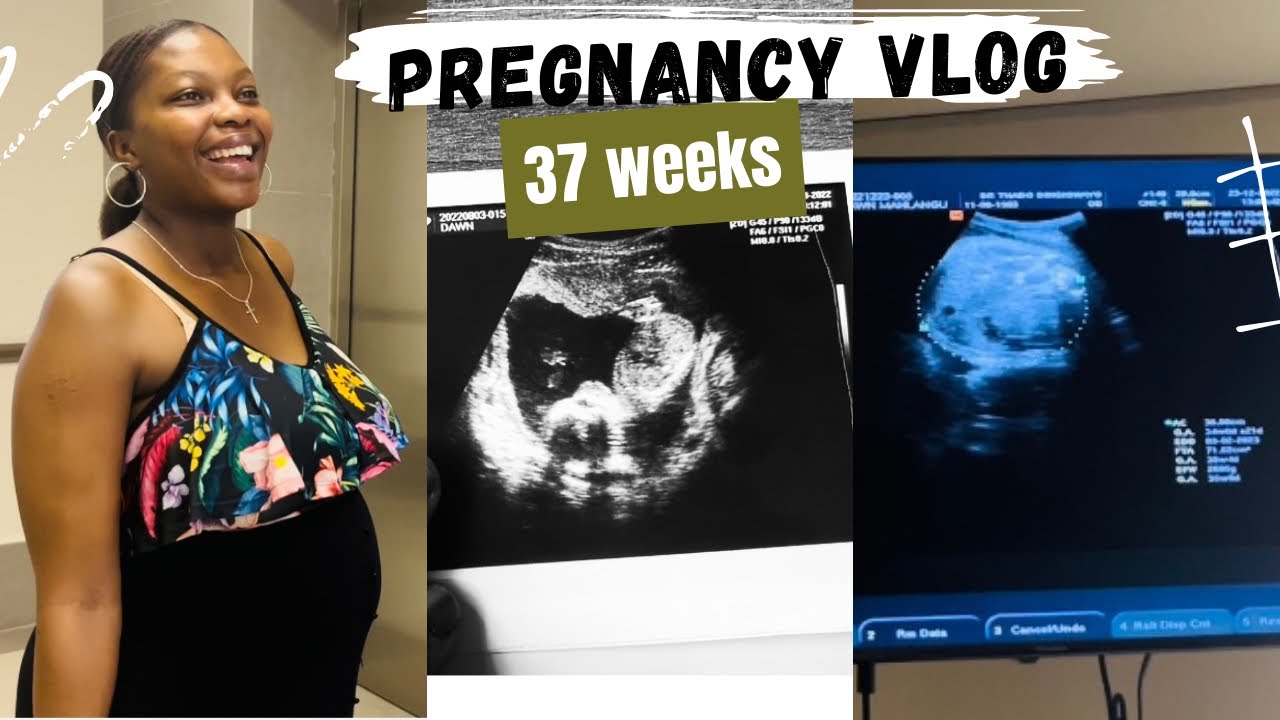 37 Weeks Pregnant | Ultrasound Scan |Gynae Visit Vlog - YouTube
