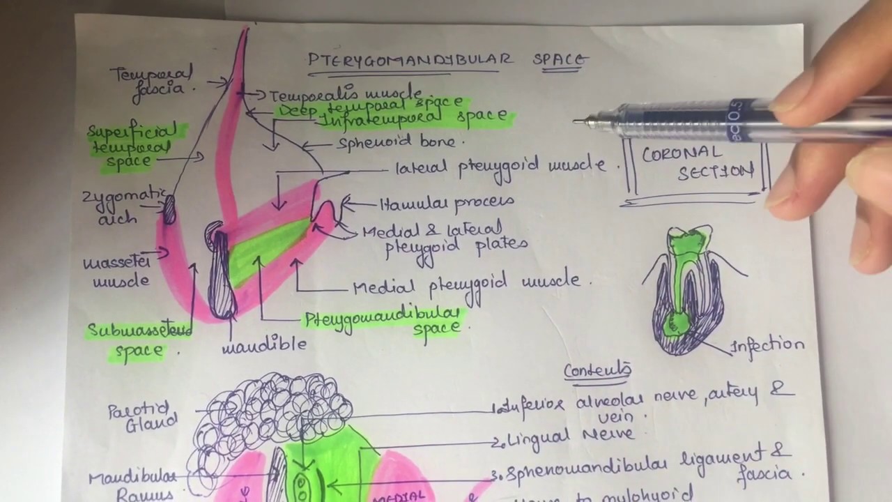 Boundaries of pterygomandibular space | contents | communication with ...