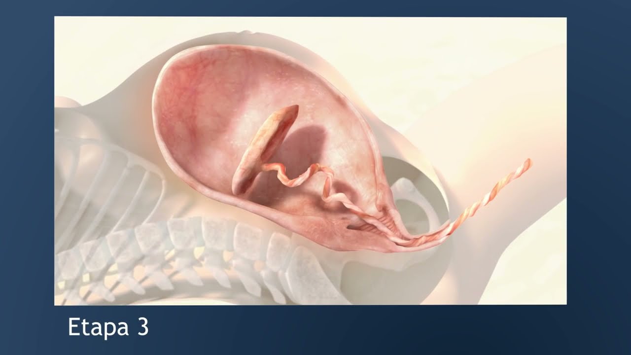 EL PARTO -Las 3 etapas del trabajo de parto - YouTube