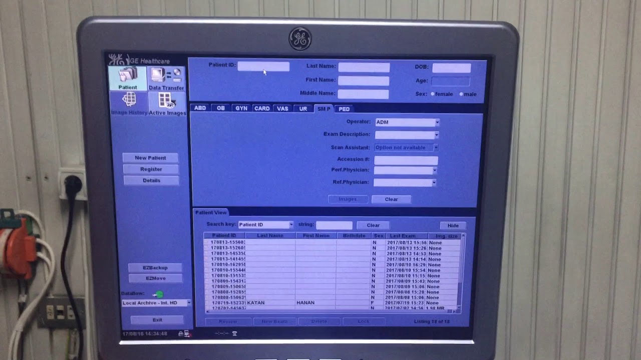 Logiq S8 introduction part 1 - YouTube