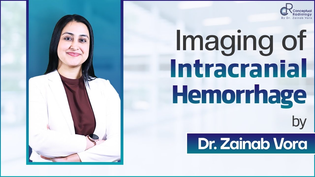 Imaging of Intracranial Hemorrhage by Dr. Zainab Vora | Conceptual ...