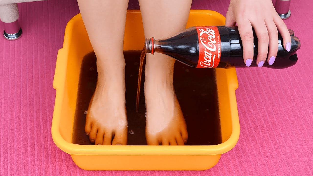 Moisten Your Feet with Coca-Cola. Softens Heels and Removes Dead Skin ...