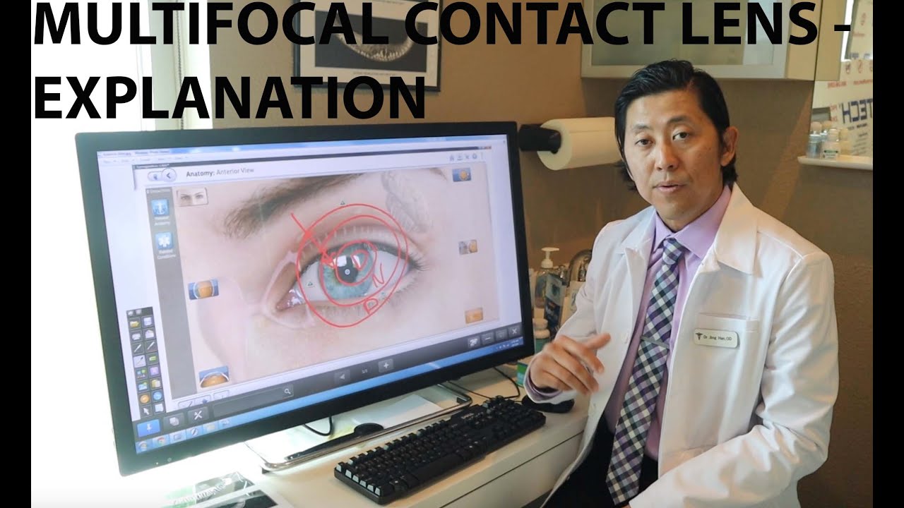 Healthy Eyes Optometry: Multifocal Contact Lens Explanation - YouTube