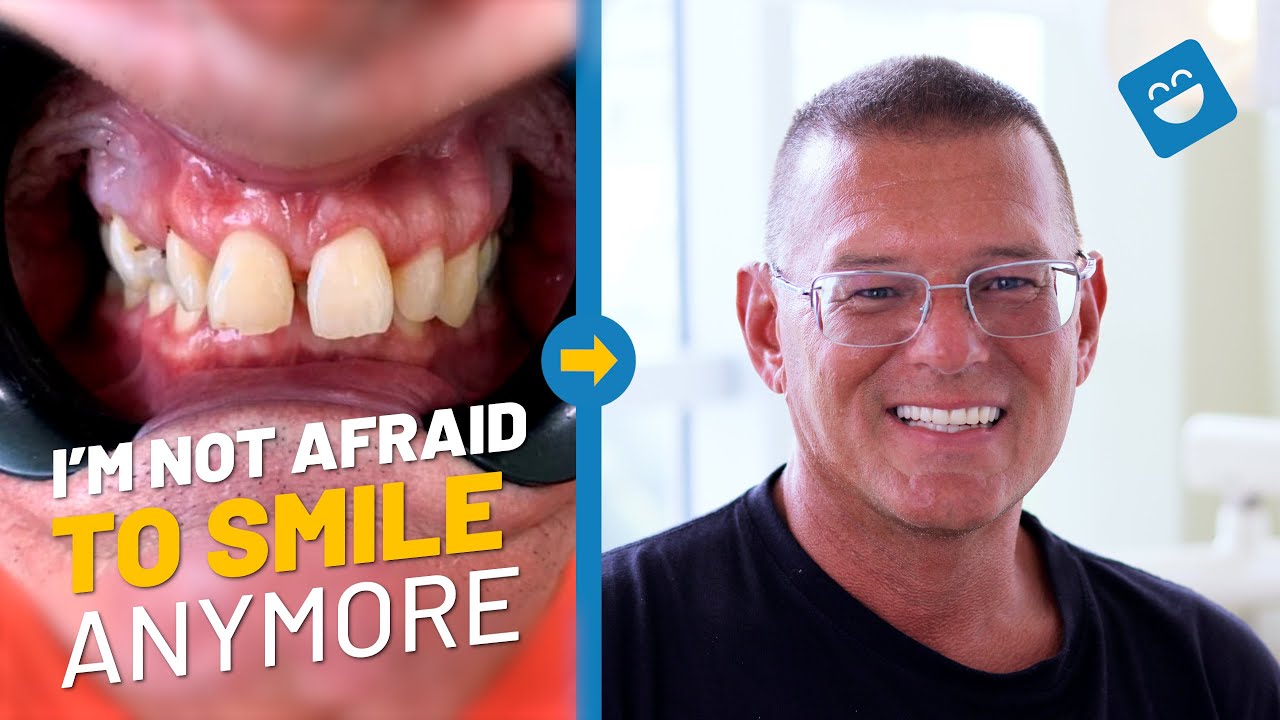 Robert's Journey: From Dental Struggles to Snap in Dentures Success! - YouTube