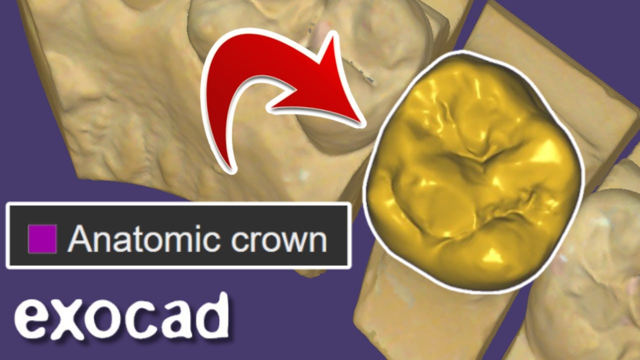 CROWN Design EXOCAD. 2024 Tutorial - YouTube