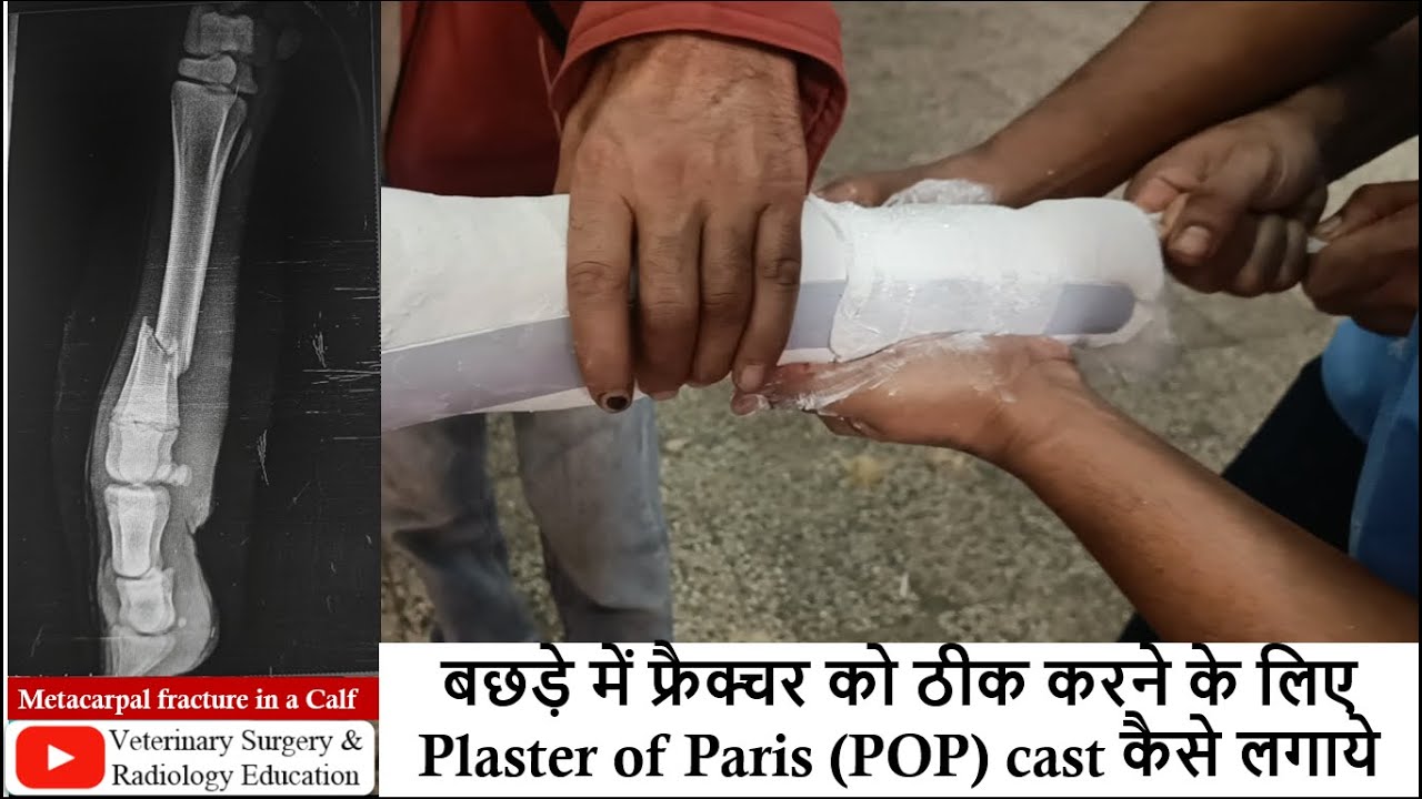 Plaster of Paris/POP cast application in calf/बछड़े के टांग टूट जाए तो ...