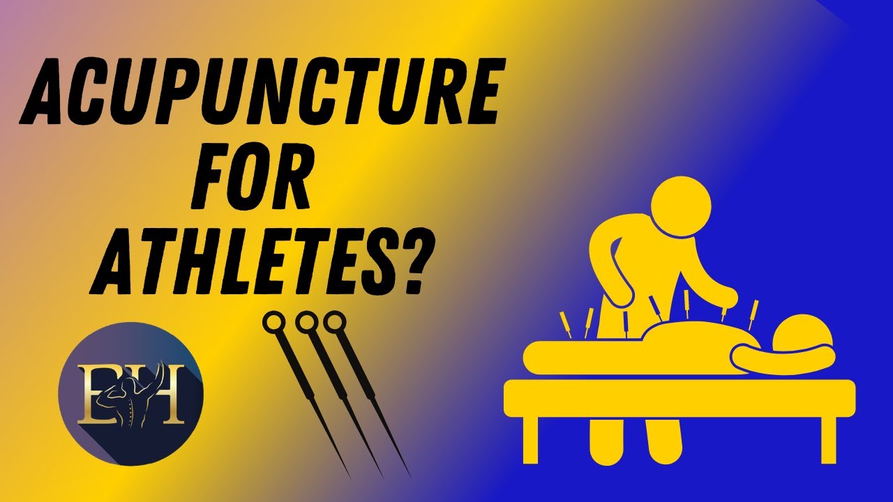 Acupuncture for Athletes? Does acupuncture work in Sports Therapy ...
