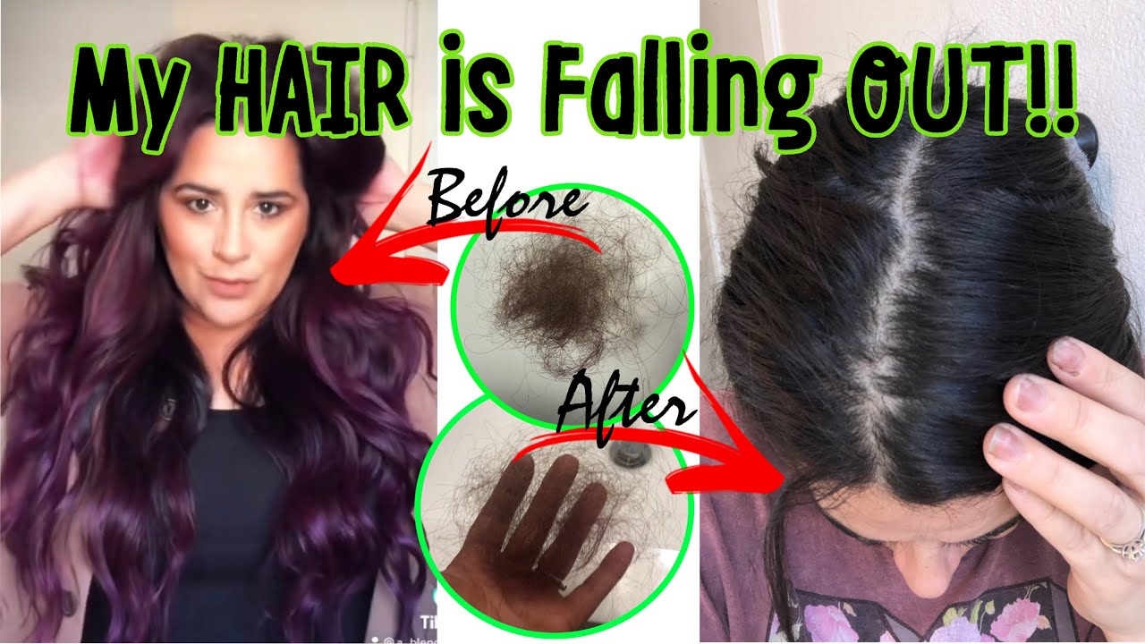 MY HAIR IS FALLING OUT | HAIRLOSS AFTER BEING SICK | HAIR ...