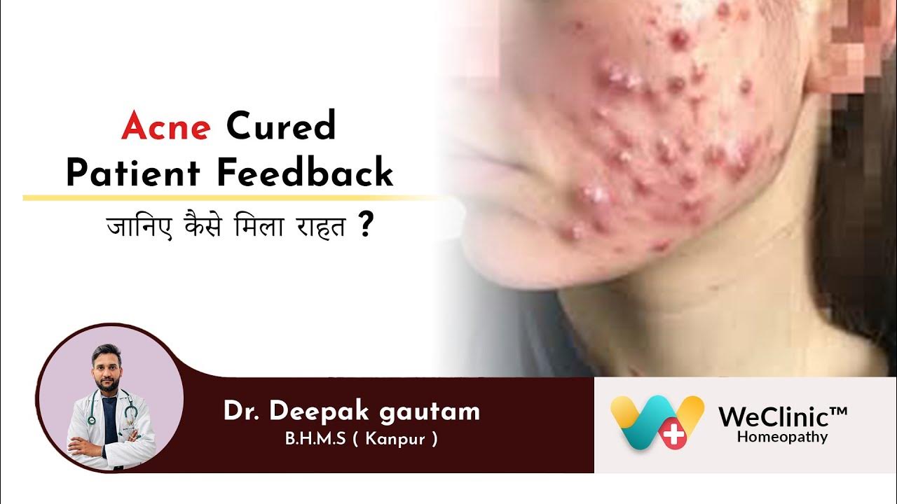 Skin Recovery Success Story Of Abhijeet mohan sakat ji | Abhijeet mohan sakat ji -117579 - YouTube