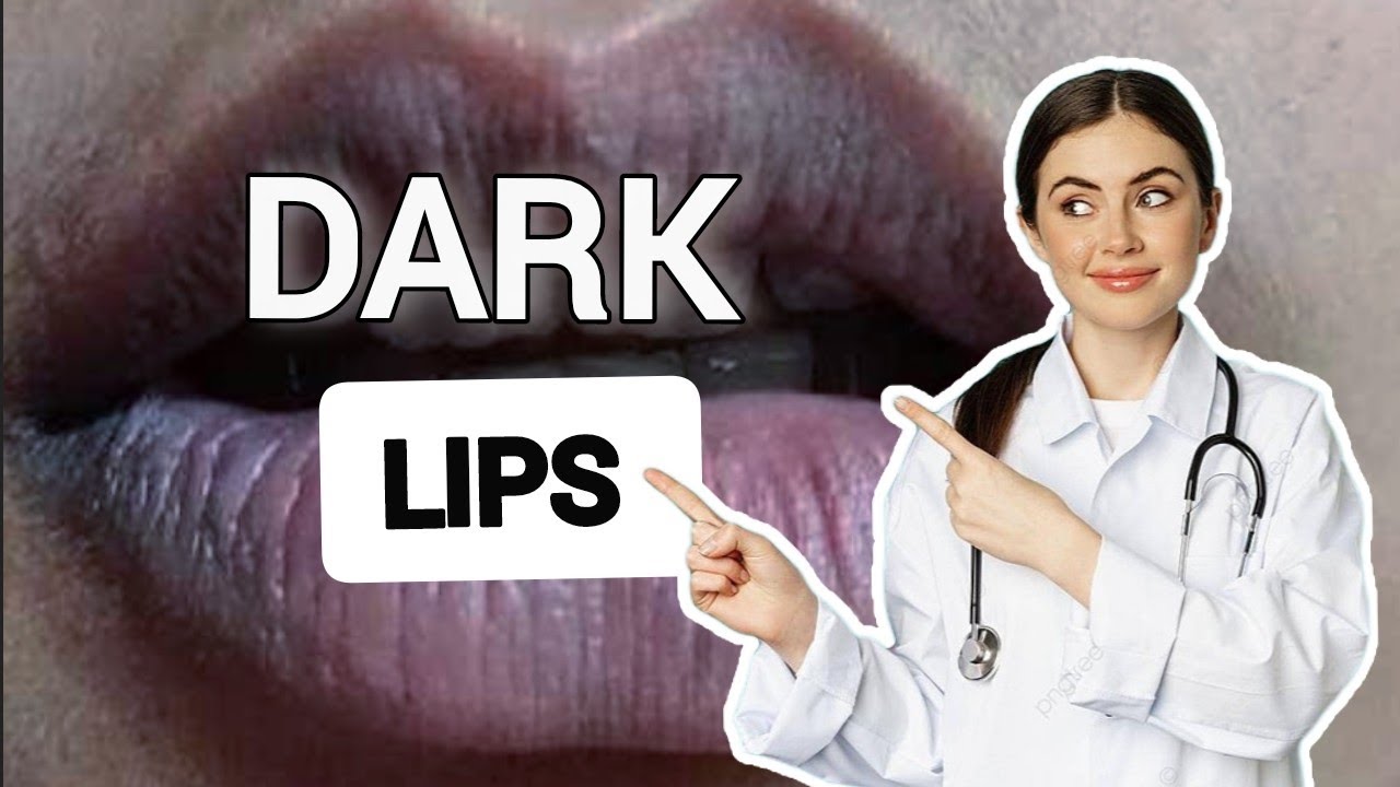 Dark lips| Avoid these mistakes | How to get pink lips | Dermatologist ...