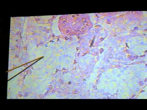 Salivary gland; mucous vs serous acini - YouTube
