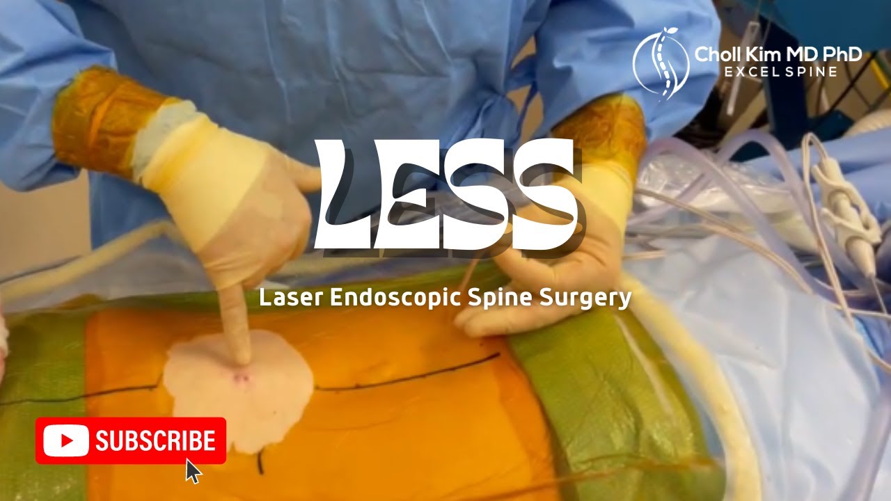LESS: L5-S1 Facet Cyst Excision - YouTube