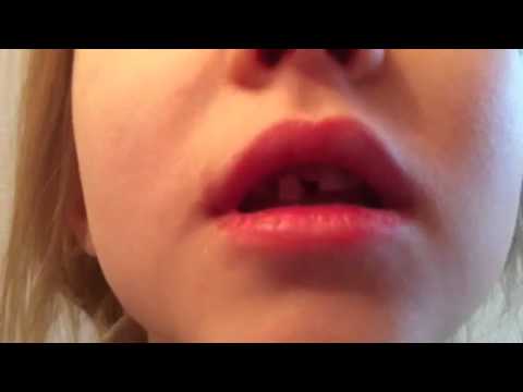 Wobbly front tooth - YouTube
