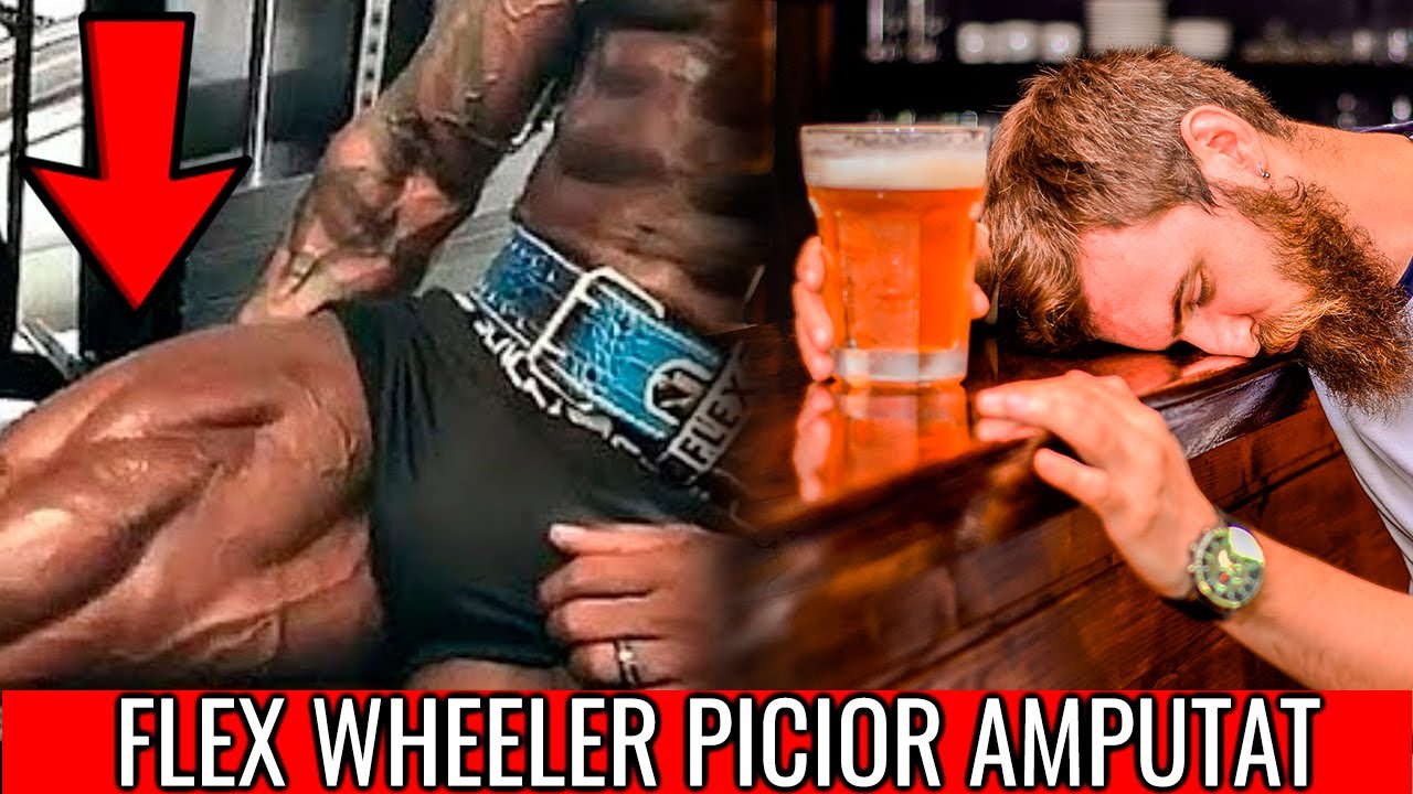 Flex Wheeler Amputare Picior | Cum te Imbeti de la Mancare? | Fitness ...