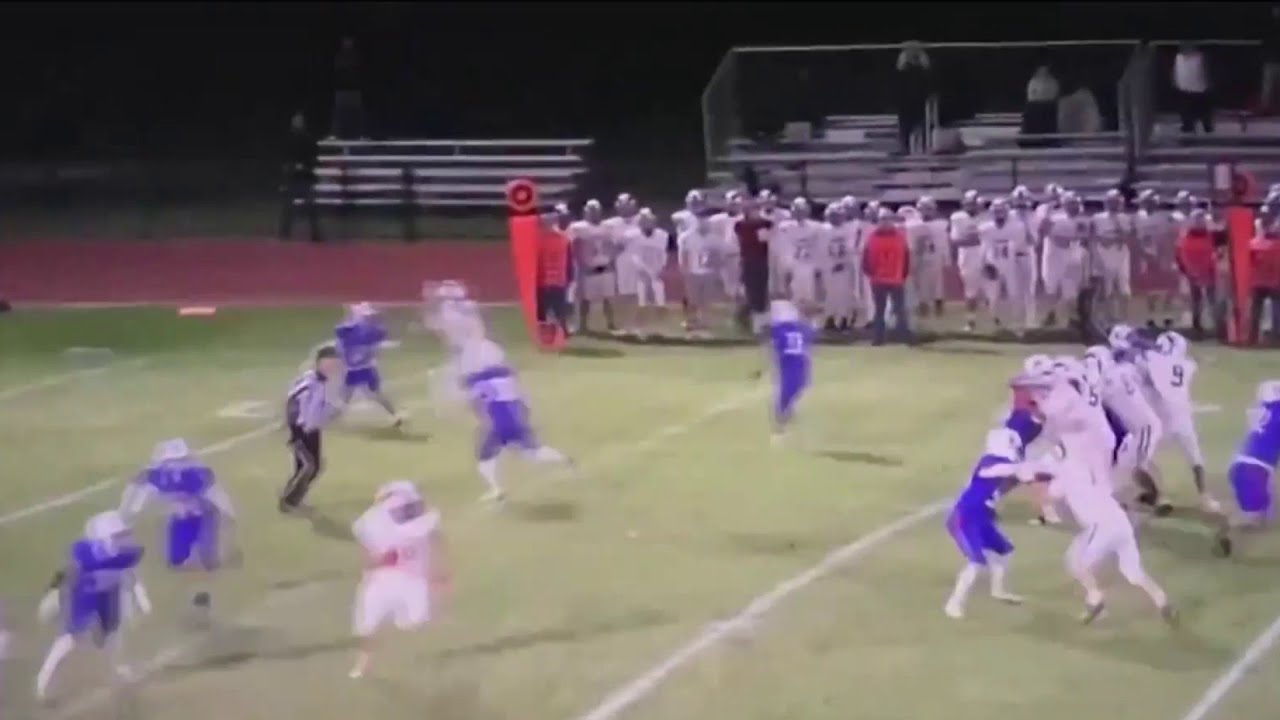 Sharon High football player undergoes surgery for TBI - YouTube
