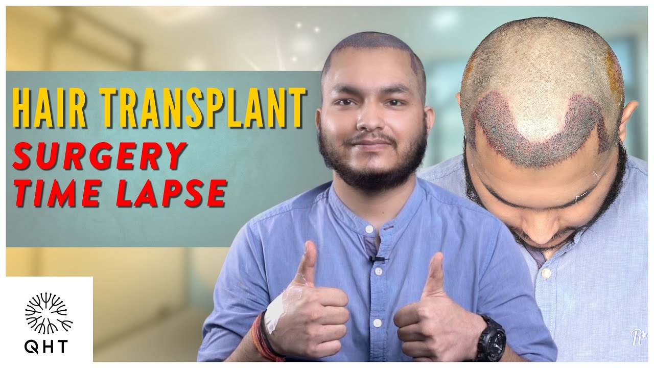 Hair Transplant Time Lapse | Step by Step Hair Transplant Surgery Time ...
