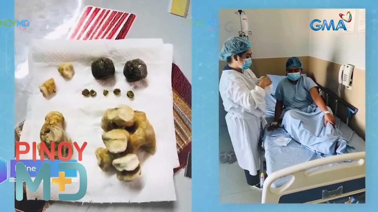 Labis na pag-inom ng softdrinks, sanhi ng pagkakaroon ng bato sa kidney ...