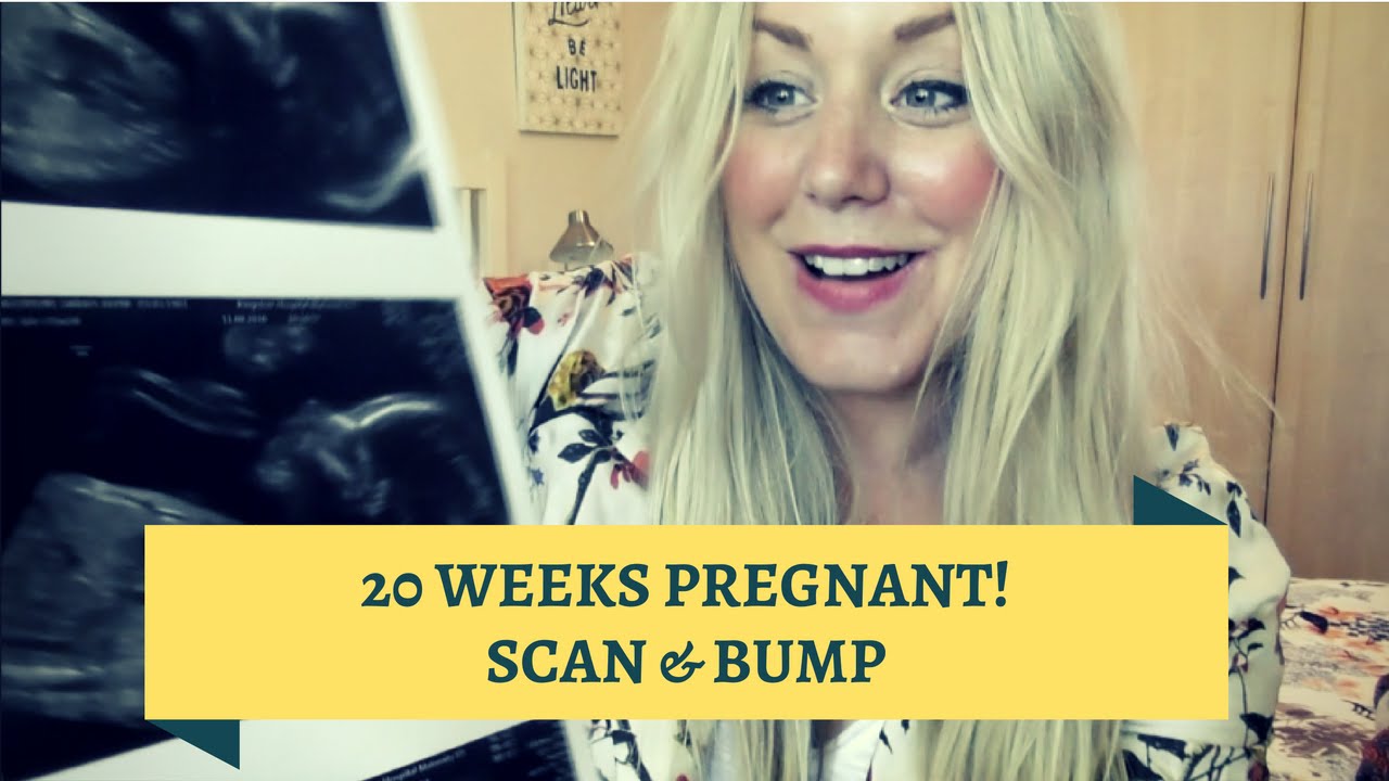 20 Week Pregnancy Update! Scan & Bump! - YouTube