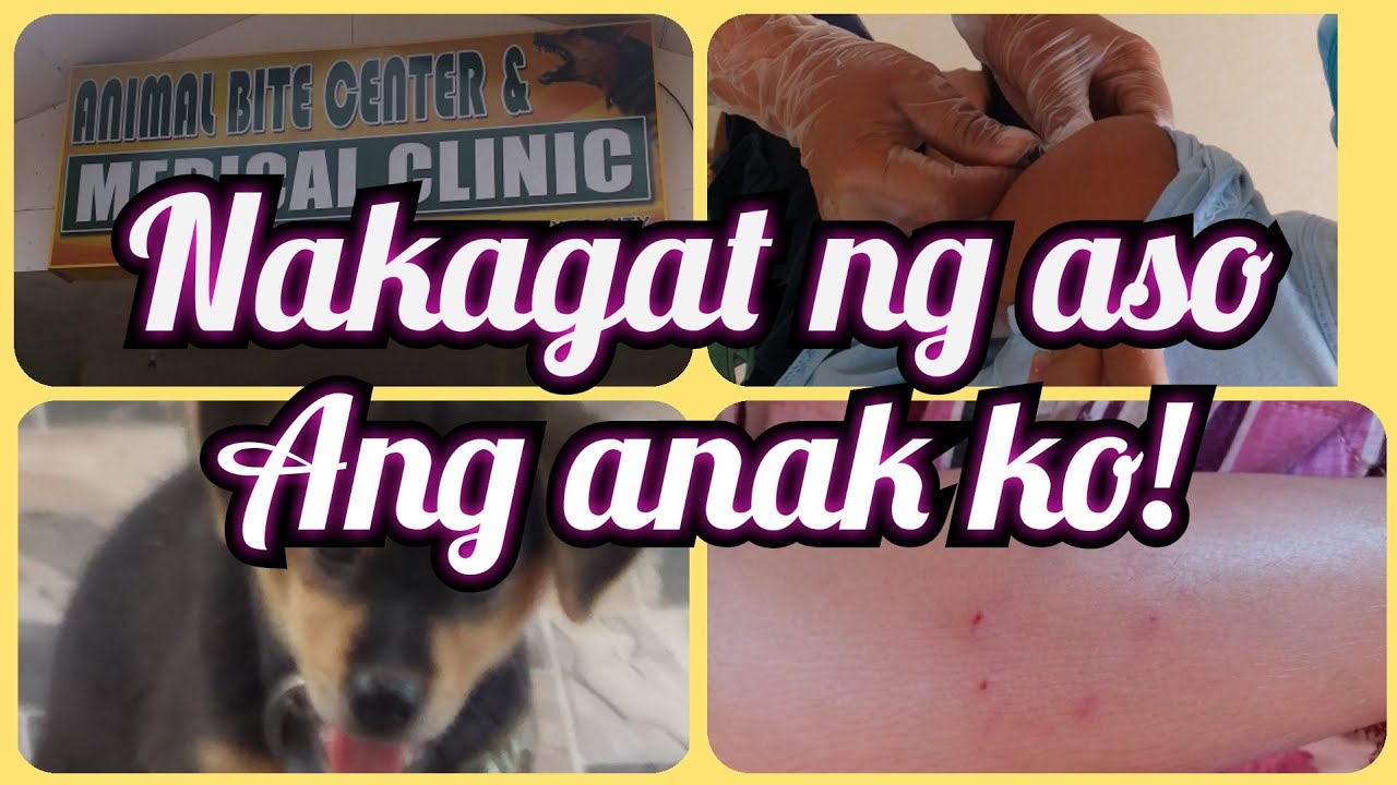 Nakagat ng aso ang anak ko! - YouTube