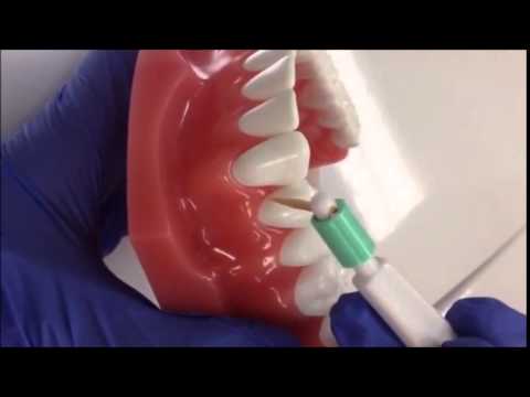 How to Use a Perio-Aid - YouTube