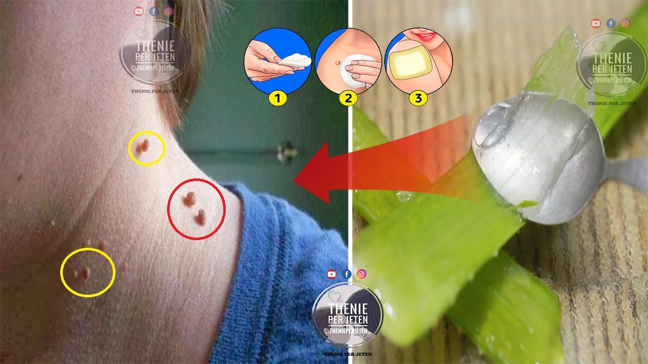 Studimi i fundit: 8 menyrat natyrale qe ju shpëtojne nga lythat ...