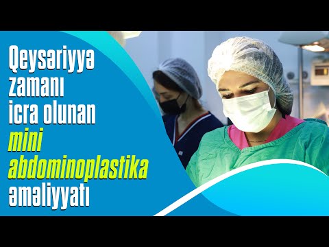 Qeysəriyyə zamanı icra olunan mini abdominoplastika əməliyyatı nədir? ( Həkim cavablandırır )