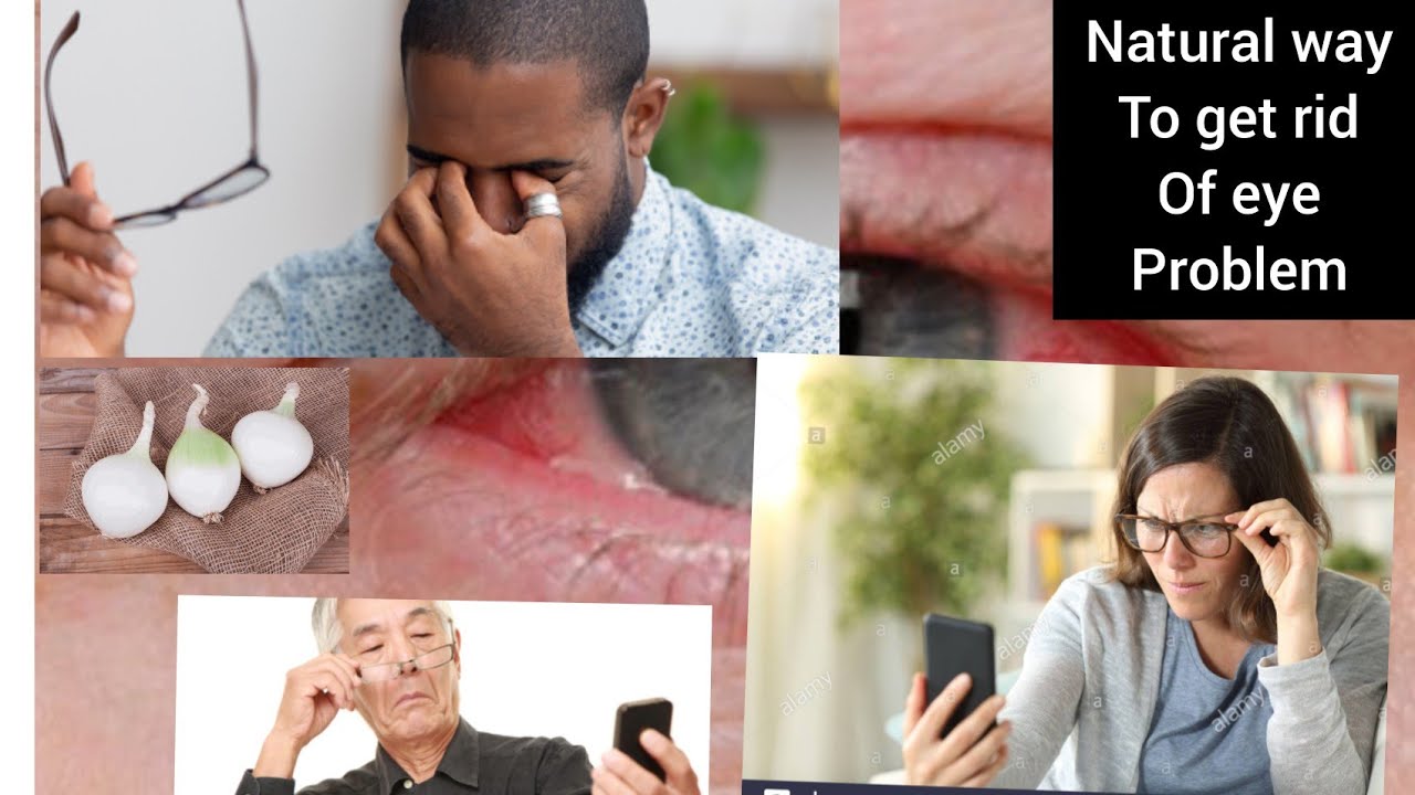 NATURAL AND EFFECTIVE WAY TO CURE EYE PROBLEM USING... ️ - YouTube