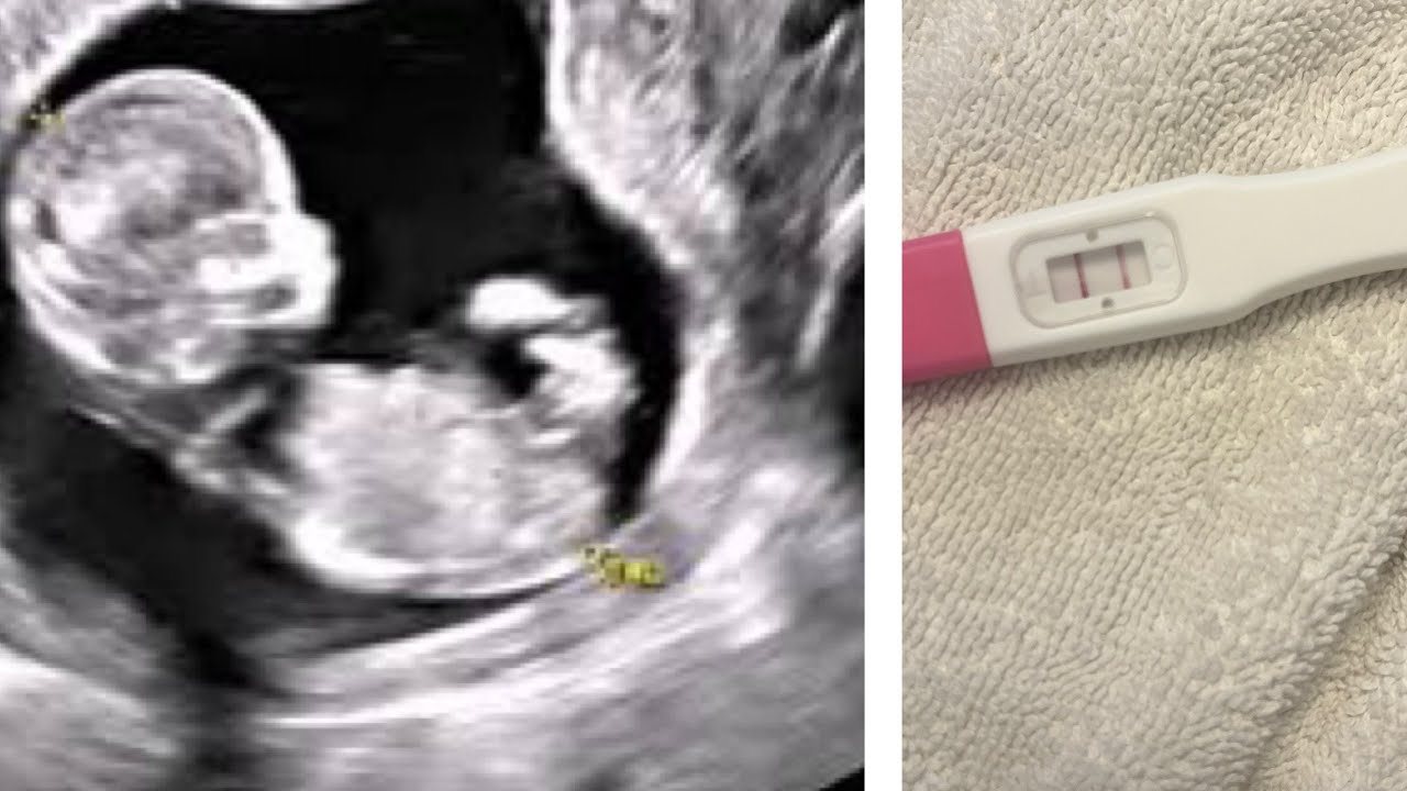 Live pregnancy test results \ big announcement baby #3 - YouTube