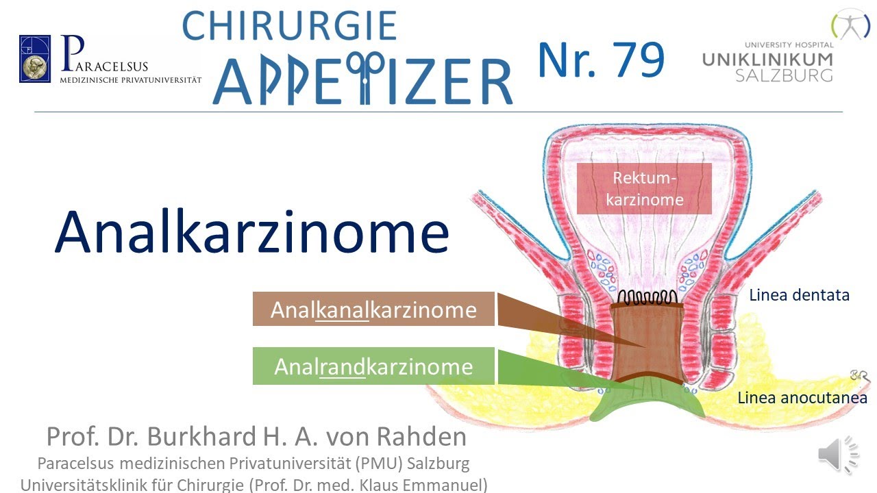 Analkarzinom (Analrandkarzinome, Analkanalkarzinome) CHIRURGIE ...
