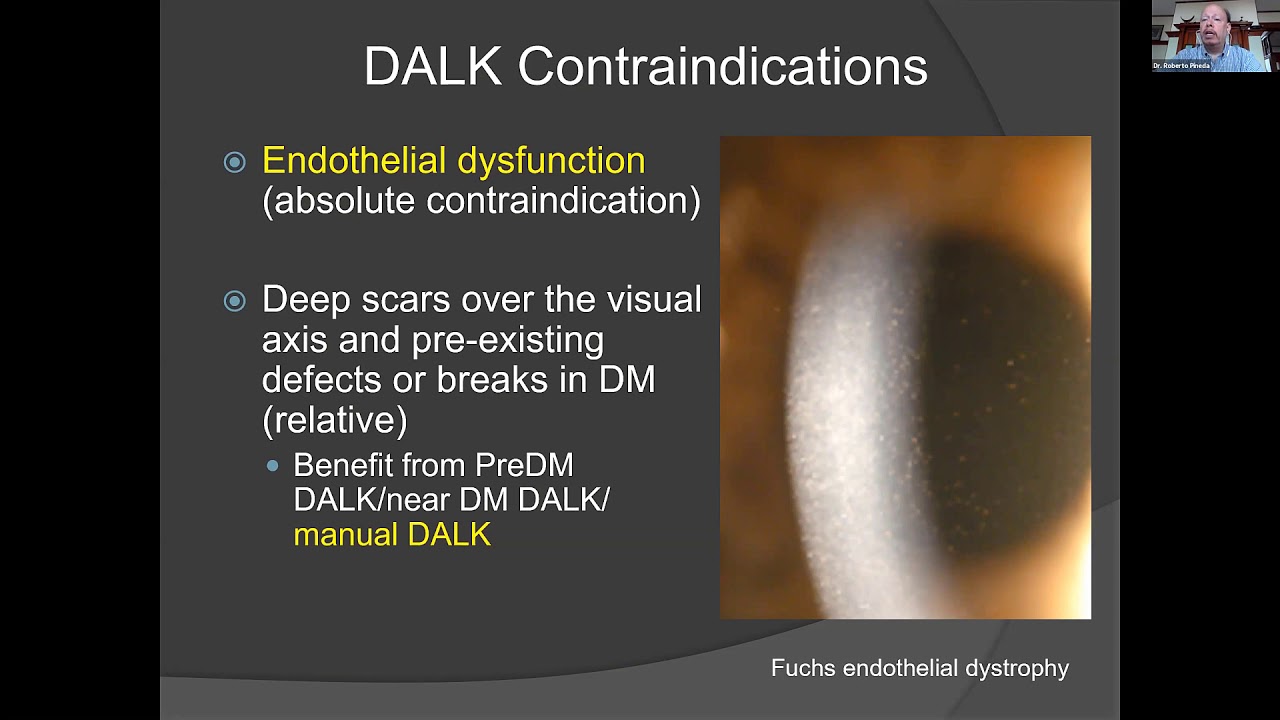 Lecture: Problem-Solving DALK - YouTube