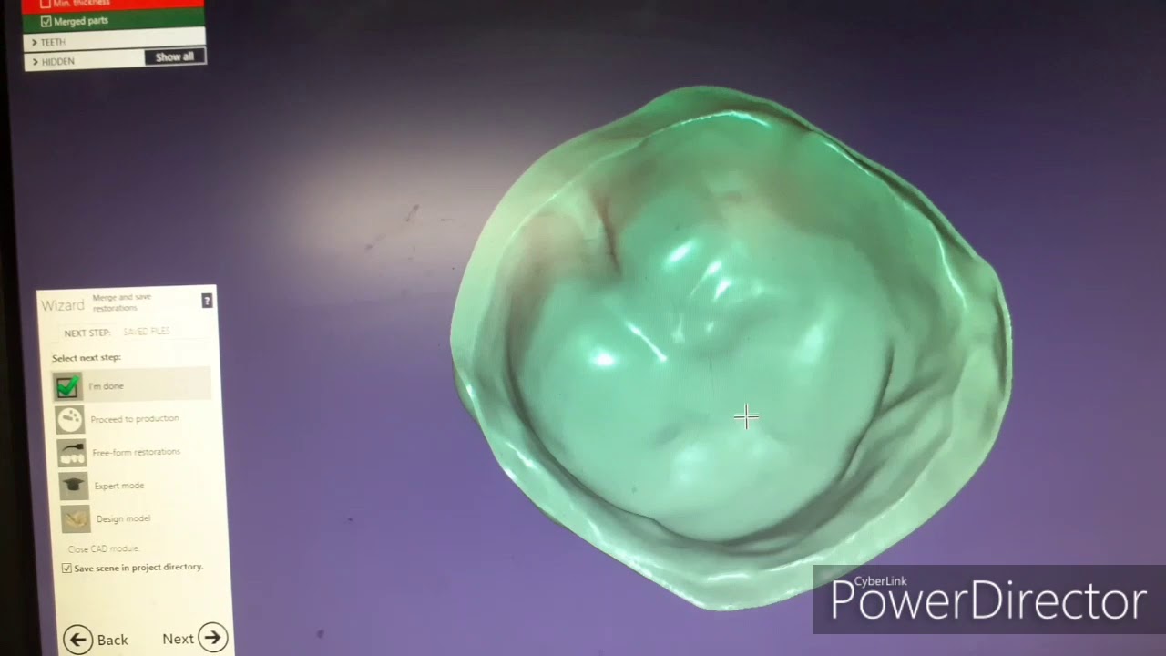 Cad cam PFM crown - YouTube