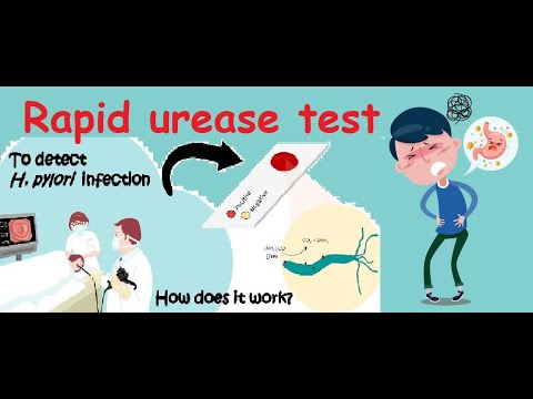 Rapid Urease test for detecting Helicobacter pylori (H. pylori ...
