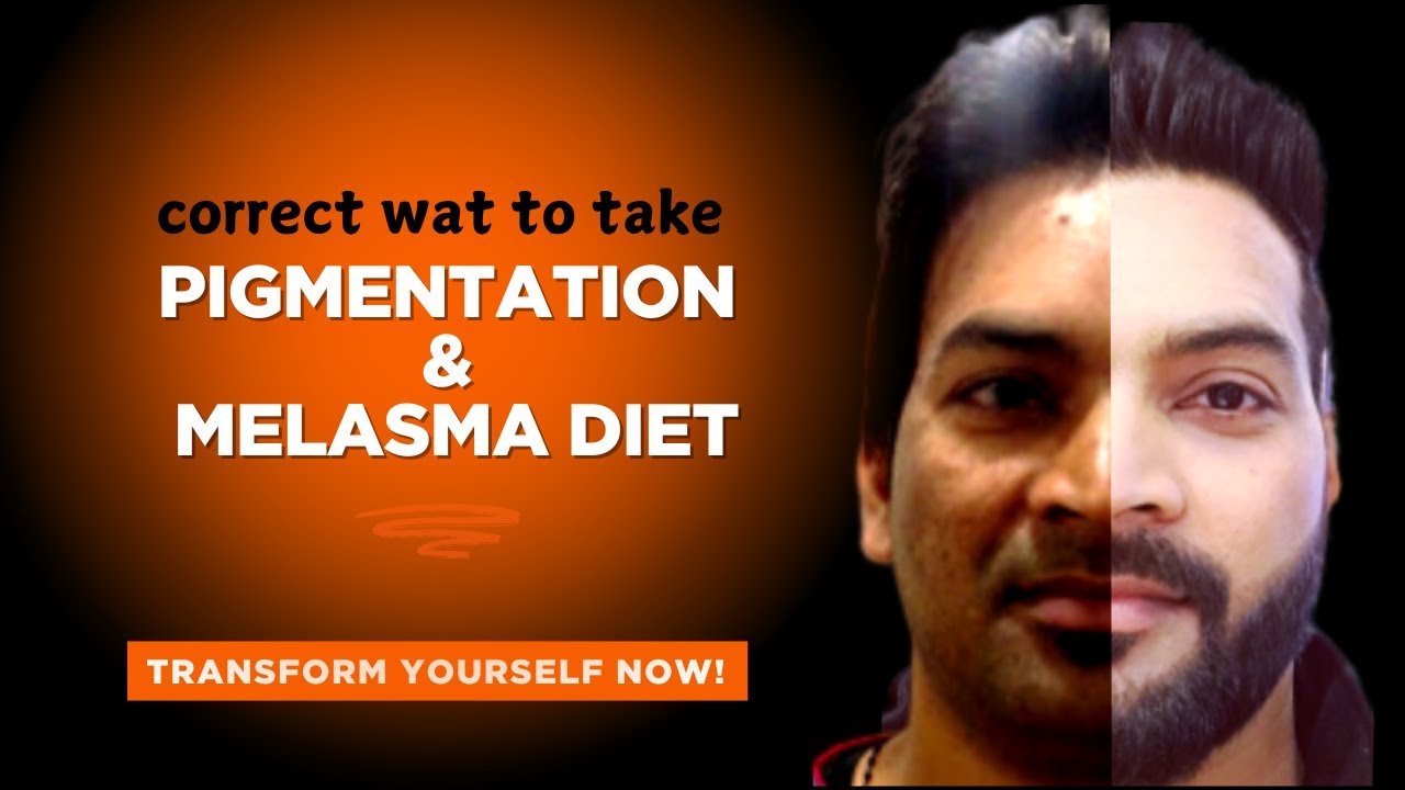 Correct way to take "Pigmentation & Melasma Diet" - YouTube