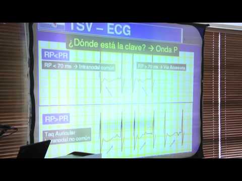 11 Dr. Daniel Rivas B.: Lectura del Electrocardiograma: Pasos ...