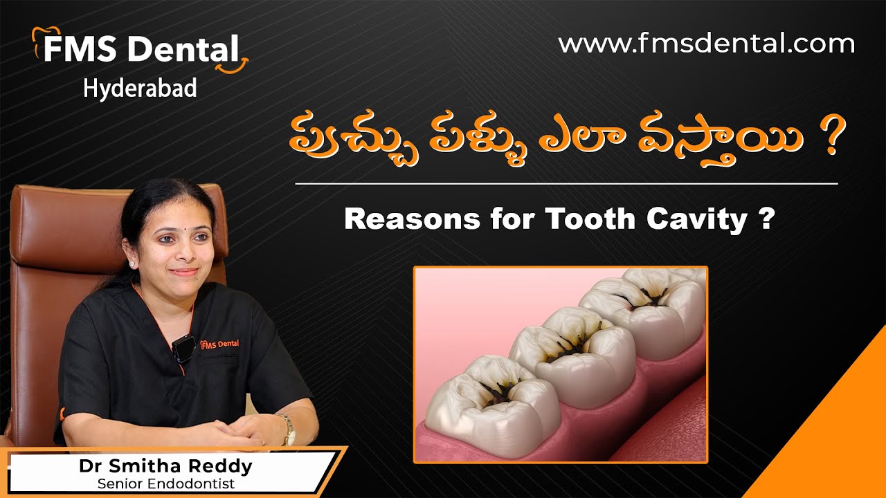 పుచ్చు పళ్ళు ఎలా వస్తాయి? | Reasons behind tooth cavity? | Dr Smitha ...