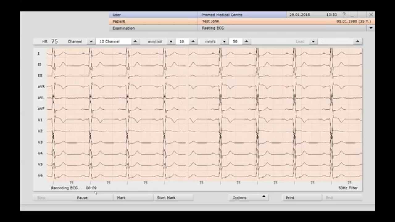 How to take an ECG directly from your patient file in Helix Practice ...
