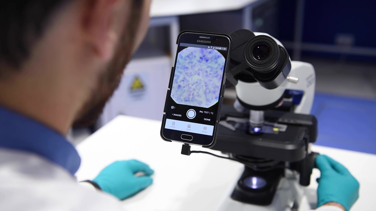 Improving Tuberculosis Monitoring with Deep Learning - YouTube