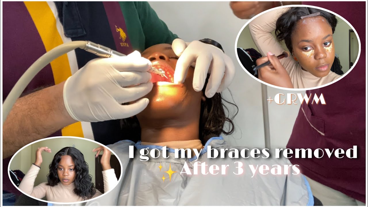 Watch me get my braces off || last video wearing braces🥹+GRWM - YouTube