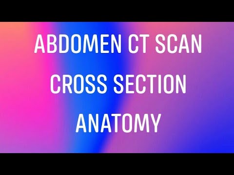 Abdomen CT scan cross section anatomy with coloured labelling - YouTube