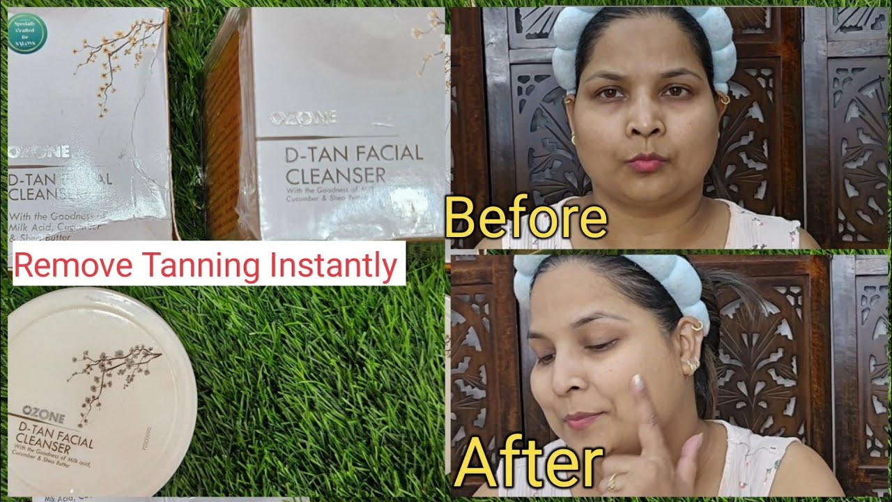 How To Remove Sun Tan from Your Face Quickly |Ozone D-Tan Facial ...