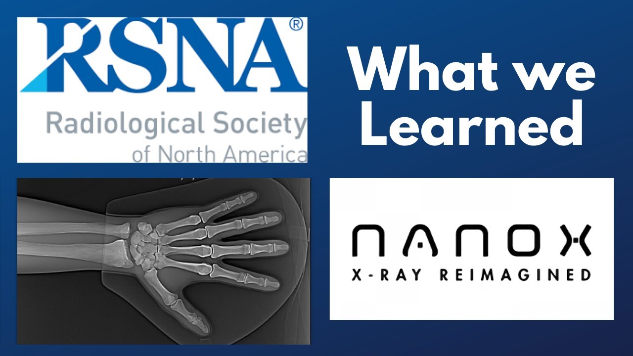 What YOU Should Know About The Nanox Live Demonstration (NNOX Stock ...