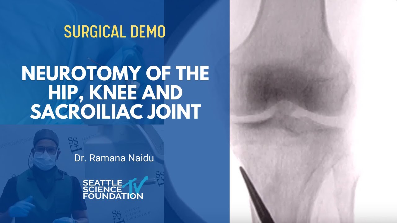 Neurotomy of the Hip Knee and Sacroiliac Joint - Ramana Naidu M.D ...
